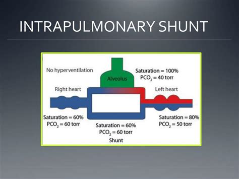 Ppt Ventilation For The Surgical Resident Powerpoint Presentation