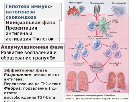 Саркоидоз состояние проблемы презентация доклад проект скачать
