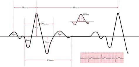Figure 1 From Recgnitionv10 Arrhythmia Detection Using Cardiologist