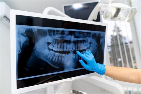 Premium Photo Dentist Reviewing Dental Xray On Computer Screen A
