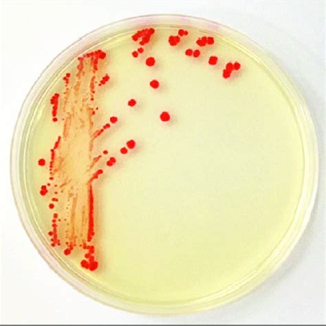 Chromagar Mdr Acinetobacter Agar Plate Showing Mdr Proteus Mirabilis Download Scientific