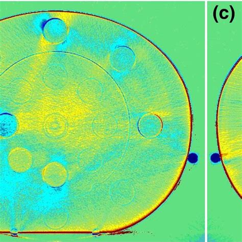 Computed Tomography Value Errors In Subtraction Images Acquired For Download Scientific Diagram