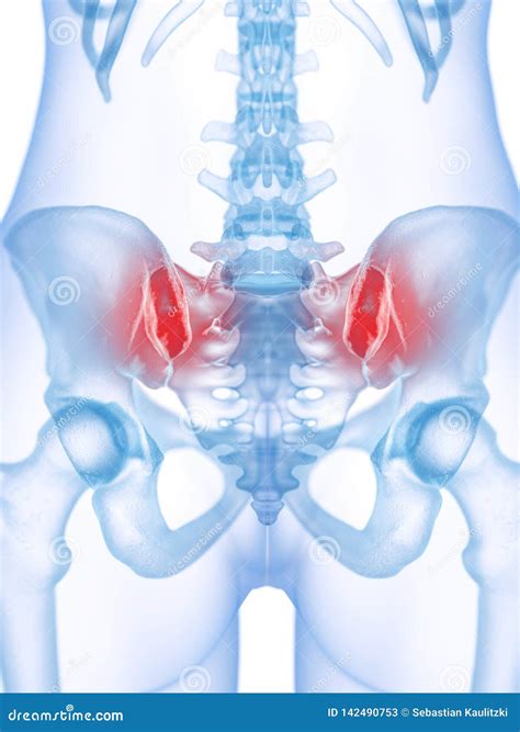 Inflammation Of The Sacroiliac Joint Of The Lower Back Royalty Free