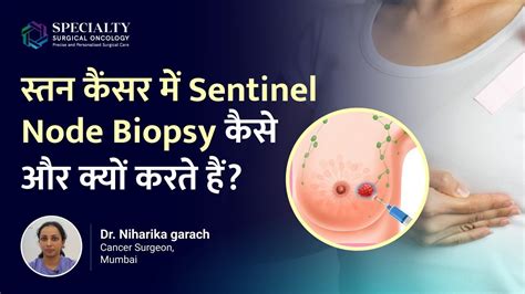 स्तन कैंसर में Sentinel Node Biopsy क्या होती है Sentinel Node