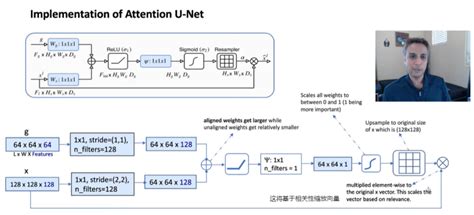 attention unet的原理对应论文 attention unet attention unet learning where to