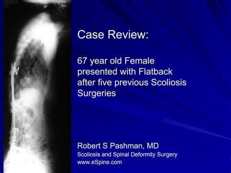 Case Review 5 67 Year Old Woman With Flatback Syndrome Following 5 Spinal Surgeries Pdf