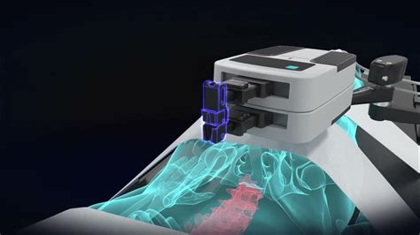 Micromate™ For Fluoroscopy Youtube