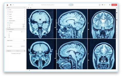 Efficiently Annotating Multi Dicom Assets Simplifying Medical Ai