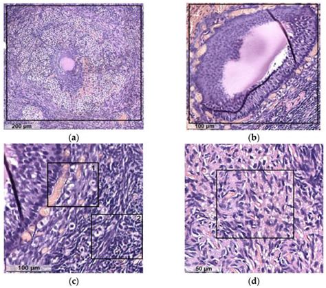 Diagnostics Special Issue Lesion Detection And Analysis Using