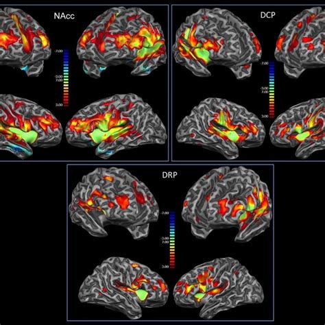 Resting State Functional Connectivity Of The Nucleus Accumbens Nacc