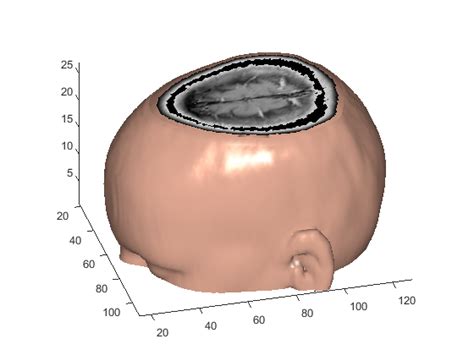 Biomedical Signal And Image Processing Projects Using Matlab And Labview Tools Example To