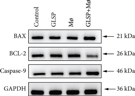 Effect Of Glsp And Mø On The Expression Of Pi3kakt And Download
