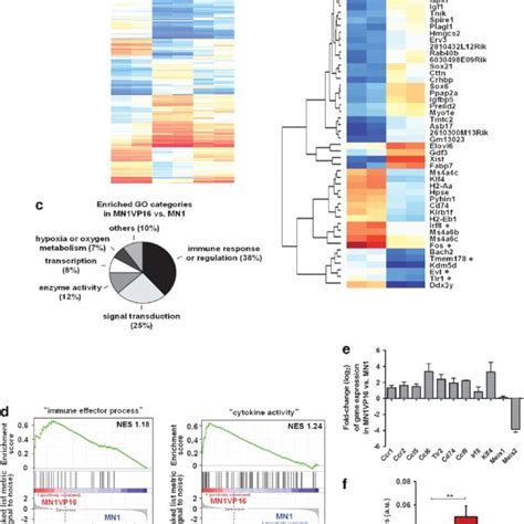 Bone Marrow Aspirate Shows A Marked Left Shift With Increased Blasts