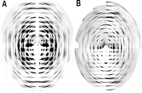 A Synchrotron X Ray Diffraction Data Collected On An Online Mar Image