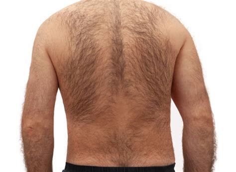 510 Hairy Back Man Fotografías De Stock Fotos E Imágenes Libres De