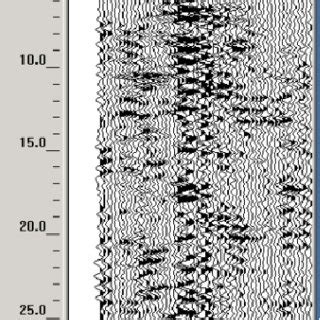 The Detection Section Of GPR Download Scientific Diagram