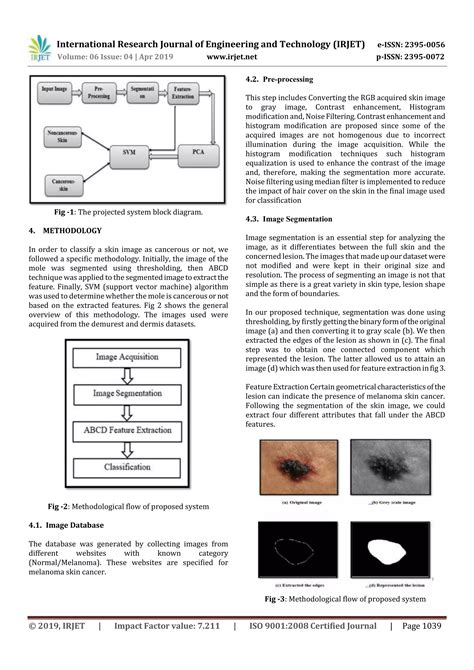 Irjet Detection And Classification Of Melanoma Skin Cancer Pdf
