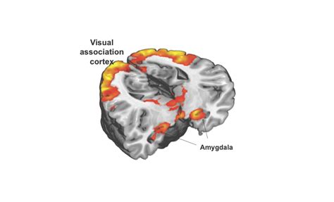 Cortex Visual Visual Cortex Visual Cortex Added A New Photo