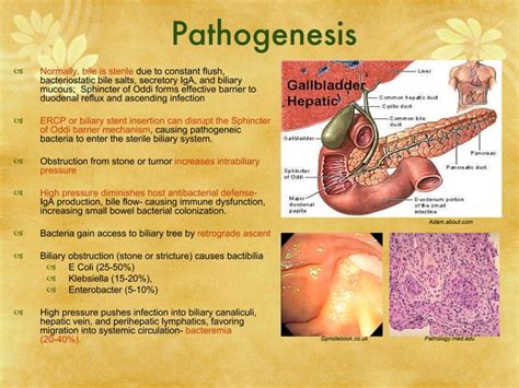 Surgery Cholangitis 1 Ppt Digestive Disorders Diseases And