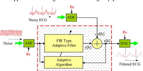 Figure 1 From Fpga Approach Of An Adaptive Filter For Ecg Signal