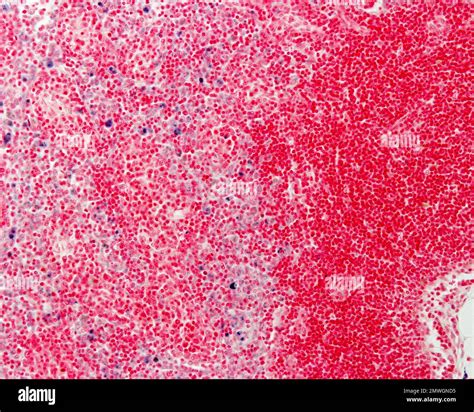 Lymph Node Macrophages Light Micrograph Stock Photo Alamy