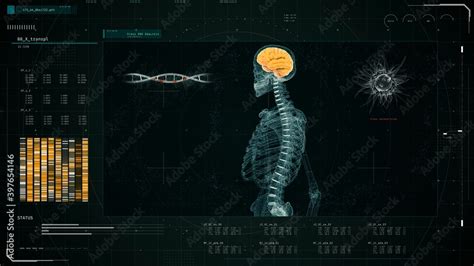 Patients Brain Scan On Screen Dna Research Genetic Disorder Detection Medical Software