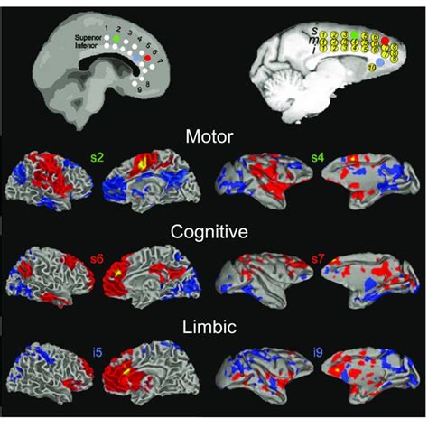 Homologous Functional Subdivisions Of The Anterior Cingulate Cortex Download Scientific