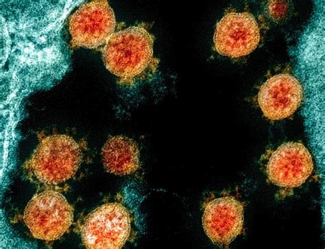 The Lambda Covid Variant Is Making Headlines Gay Pages Sa