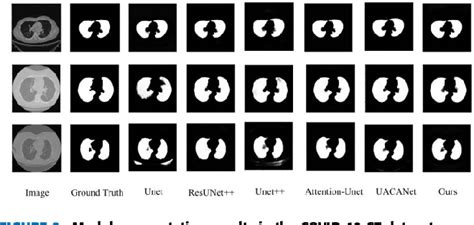 Figure 1 From Medical Image Segmentation Based On Transformer And Hardnet Structures Semantic