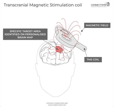 Transcranial Magnetic Stimulation TMS Connectomix