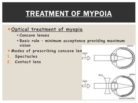 Myopia Pptx Eye And Vision Conditions Diseases And Conditions