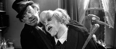 Sloní Muž Znetvorenie Ako Nočná Mora 1 časť Topdesať