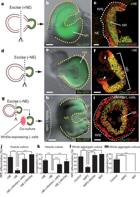 Self Patterning Into Neural Retina And Rpe Via Interactions With