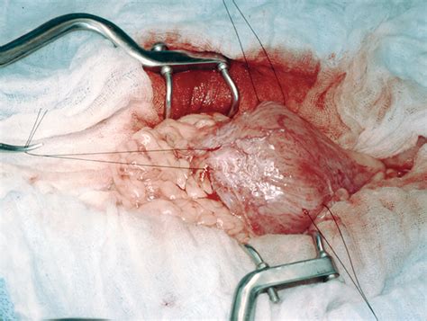 Step By Step Cystotomy Clinicians Brief