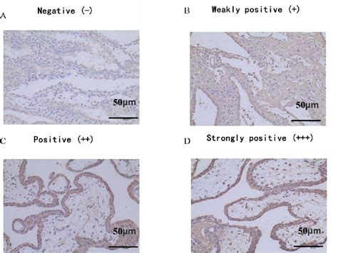 Figure 1 From Expression And Correlation Of Complement C3 And C4 In Serum And Maternal Fetal