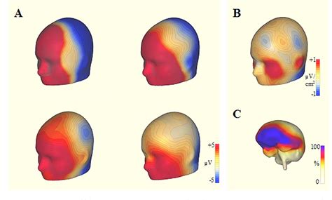 Figure 3 From Topography And Elimination Of Slow Eeg Responses Related