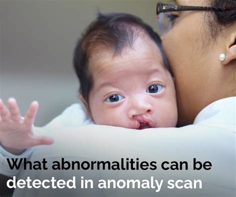 what abnormalities in anomaly scan can be detected