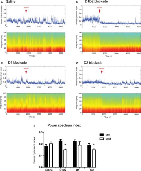 AD Examples Of LFP Power Spectra And Corresponding Power Spectrum Download Scientific