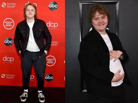 Lewis Capaldi Weight Gain Journey Insights And Understanding