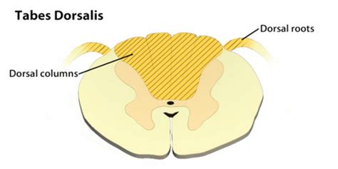 Spinal Cord Flashcards Quizlet
