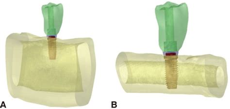 Structures Of The Three Dimensional Finite Element Models A Finite Download Scientific