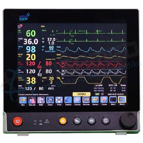 Patient Monitor 5 Parameter Standard Vsm 125 Pt Bintang Sarana Medika