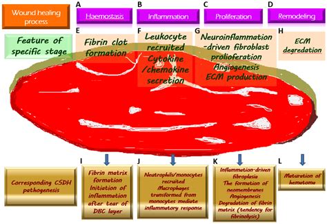 Subdural Hematoma Pathophysiology
