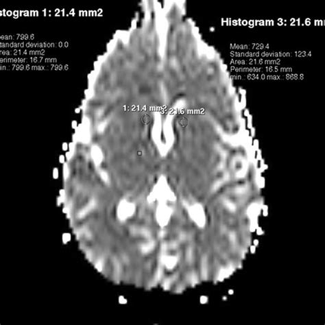ADC Value Measurement In SC Download Scientific Diagram
