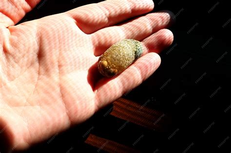 Premium Photo Gallstone Disease Cholelithiasis The Formation Of