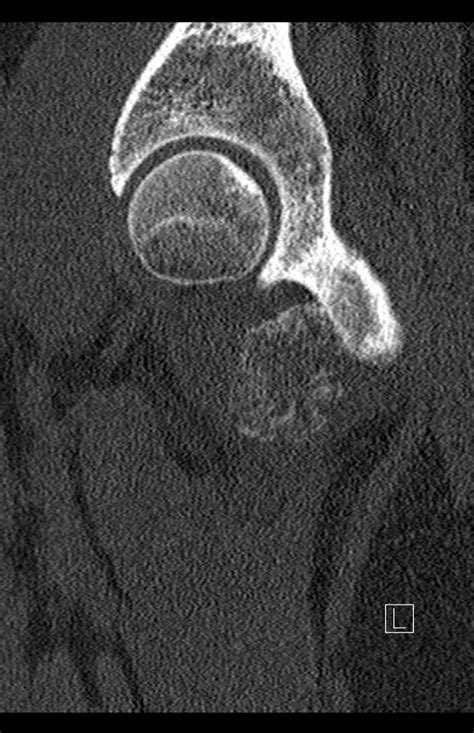 Skeletal Dont Touch Lesions Radiology Case Collection