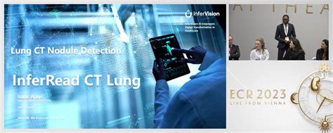 Lung Ct Nodule Detection Esr Connect