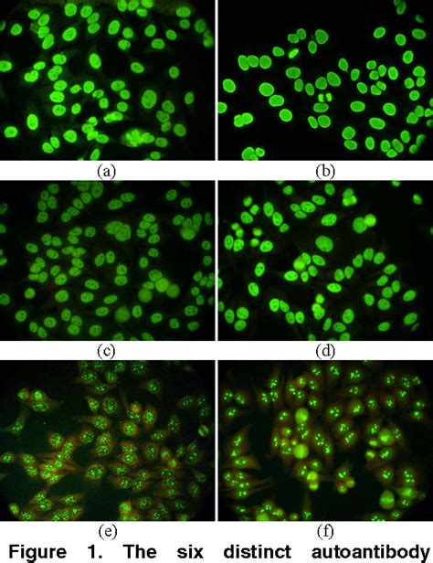 Figure From Adaptive Automatic Segmentation Of HEp Cells In Indirect Immunofluorescence