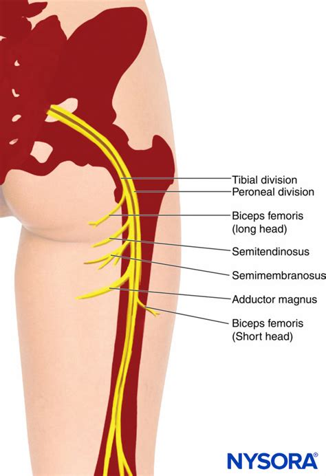 Nerve To Quadratus Femoris And Sciatic Nerve