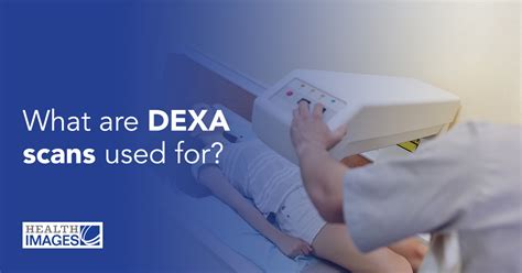What Are Dexa Scans Used For Health Images